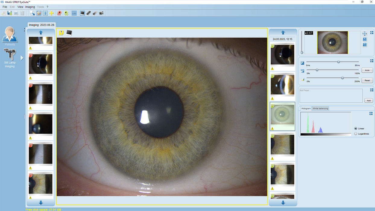 Slit lamp imaging